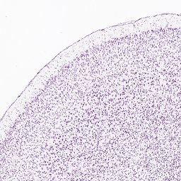 Interactive Atlas Viewer :: Atlas Viewer