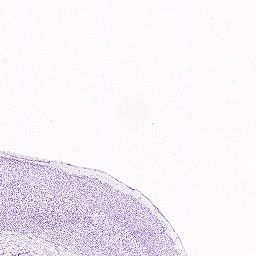 Interactive Atlas Viewer :: Atlas Viewer