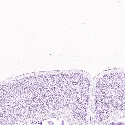 Interactive Atlas Viewer :: Atlas Viewer