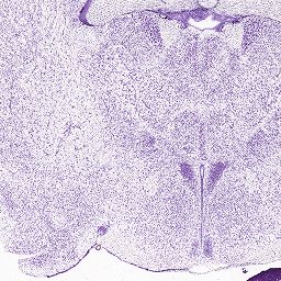 Interactive Atlas Viewer :: Atlas Viewer