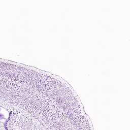 Interactive Atlas Viewer :: Atlas Viewer