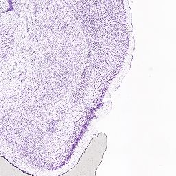 Interactive Atlas Viewer :: Atlas Viewer