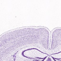 Interactive Atlas Viewer :: Atlas Viewer