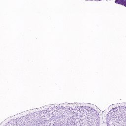 Interactive Atlas Viewer :: Atlas Viewer