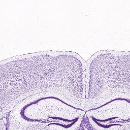 Interactive Atlas Viewer :: Atlas Viewer