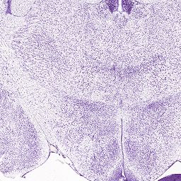 Interactive Atlas Viewer :: Atlas Viewer