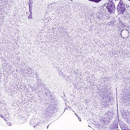 Interactive Atlas Viewer :: Atlas Viewer