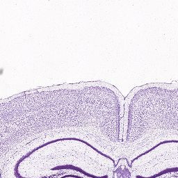 Interactive Atlas Viewer :: Atlas Viewer