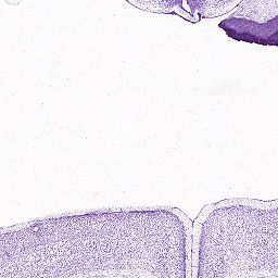 Interactive Atlas Viewer :: Atlas Viewer