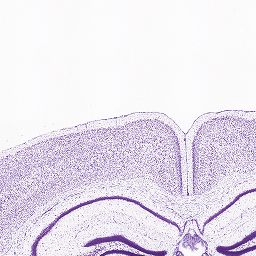 Interactive Atlas Viewer :: Atlas Viewer