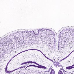 Interactive Atlas Viewer :: Atlas Viewer