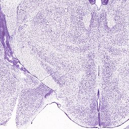 Interactive Atlas Viewer :: Atlas Viewer