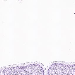 Interactive Atlas Viewer :: Atlas Viewer