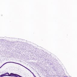 Interactive Atlas Viewer :: Atlas Viewer