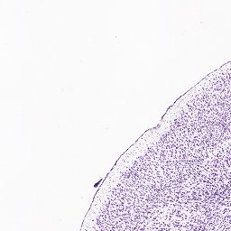 Interactive Atlas Viewer :: Atlas Viewer