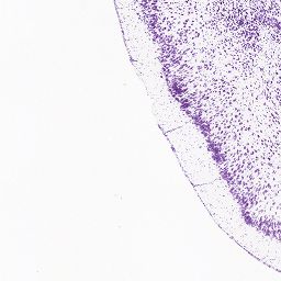 Interactive Atlas Viewer :: Atlas Viewer