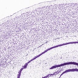 Interactive Atlas Viewer :: Atlas Viewer