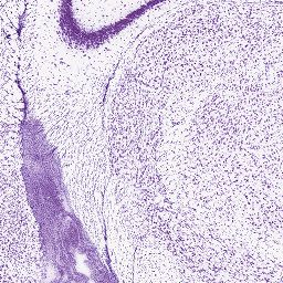 Interactive Atlas Viewer :: Atlas Viewer