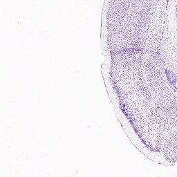 Interactive Atlas Viewer :: Atlas Viewer