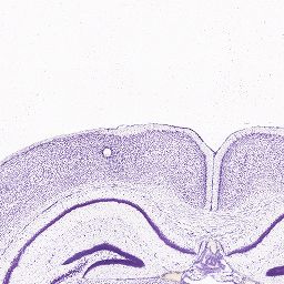 Interactive Atlas Viewer :: Atlas Viewer