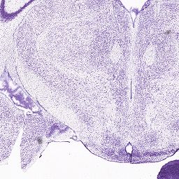 Interactive Atlas Viewer :: Atlas Viewer