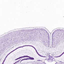 Interactive Atlas Viewer :: Atlas Viewer