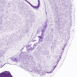 Interactive Atlas Viewer :: Atlas Viewer