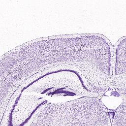 Interactive Atlas Viewer :: Atlas Viewer