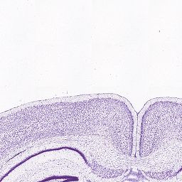 Interactive Atlas Viewer :: Atlas Viewer