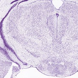 Interactive Atlas Viewer :: Atlas Viewer