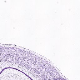 Interactive Atlas Viewer :: Atlas Viewer