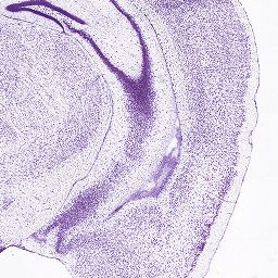 Interactive Atlas Viewer :: Atlas Viewer