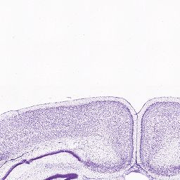 Interactive Atlas Viewer :: Atlas Viewer