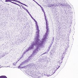 Interactive Atlas Viewer :: Atlas Viewer