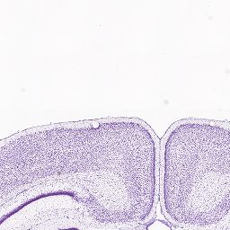 Interactive Atlas Viewer :: Atlas Viewer