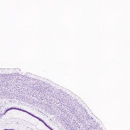 Interactive Atlas Viewer :: Atlas Viewer