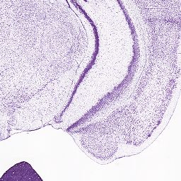 Interactive Atlas Viewer :: Atlas Viewer