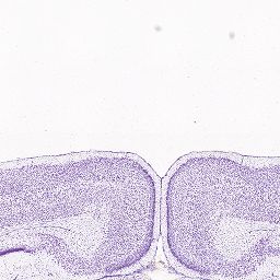 Interactive Atlas Viewer :: Atlas Viewer