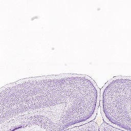 Interactive Atlas Viewer :: Atlas Viewer