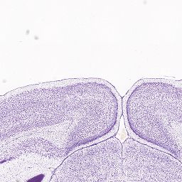 Interactive Atlas Viewer :: Atlas Viewer