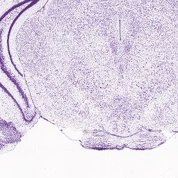 Interactive Atlas Viewer :: Atlas Viewer