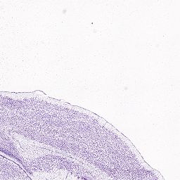 Interactive Atlas Viewer :: Atlas Viewer