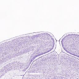 Interactive Atlas Viewer :: Atlas Viewer