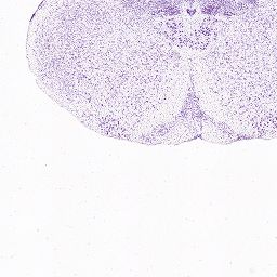 Interactive Atlas Viewer :: Atlas Viewer